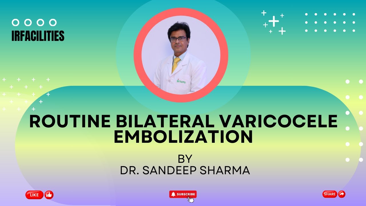 Routine Bilateral Varicocele Embolization By Dr. Sandeep Sharma. - YouTube