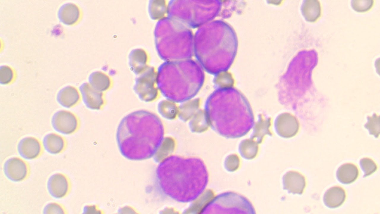 LIVE- ANÁLISE DE LÂMINA-LMA-M3 - YouTube