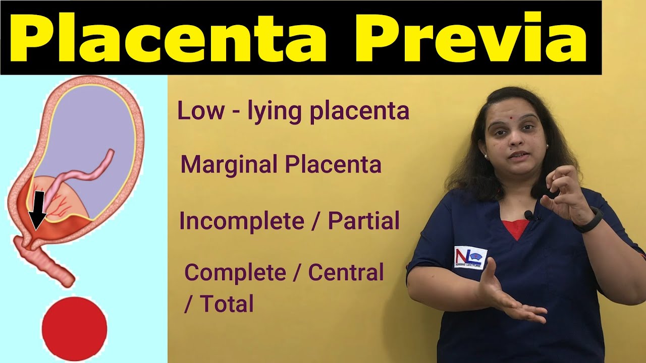 Placenta Previa | APH | Antepartum Hemorrhage-Types, Risk factors ...