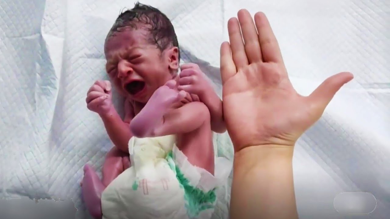 Newborn babies reflexes. Which of neonatal reflex did you see. - YouTube