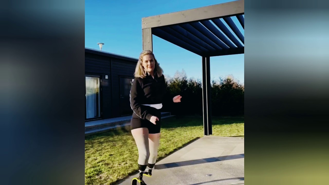 Amputee double dancing with prosthesis. - YouTube