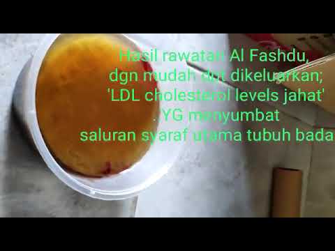 Rawatan detox Al Fashdu; mengeluarkan tocxid2 jahat, LDL cholesterol ...