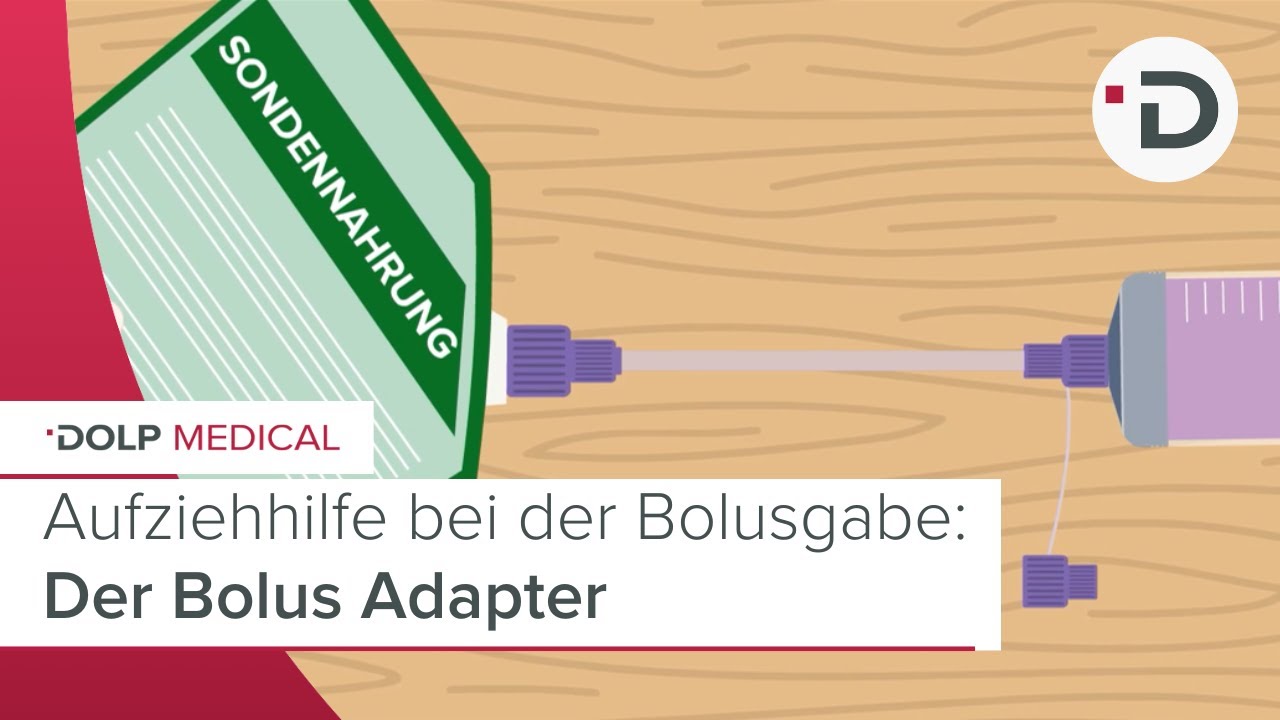 Bolus Adapter I Aufziehhilfe bei der Bolusgabe von Sondennahrung - YouTube