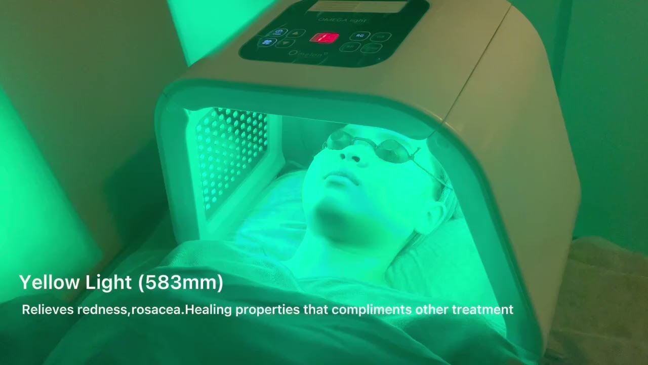 Omega Light Treatment - YouTube