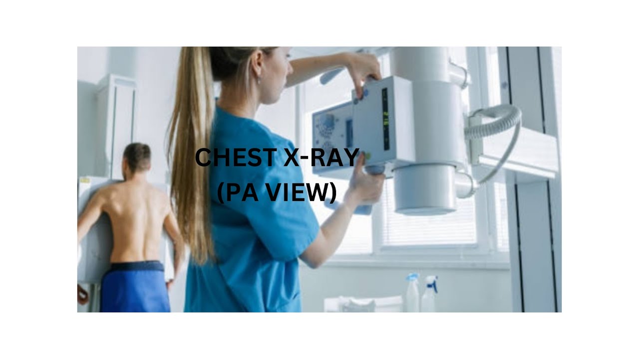 Chest x-ray. pt 1 (PA view) - YouTube