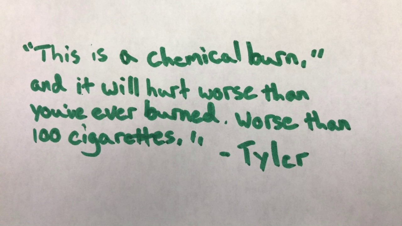 Arnold, Scene 6, Tyler Gives Jack the Lye Burn - YouTube