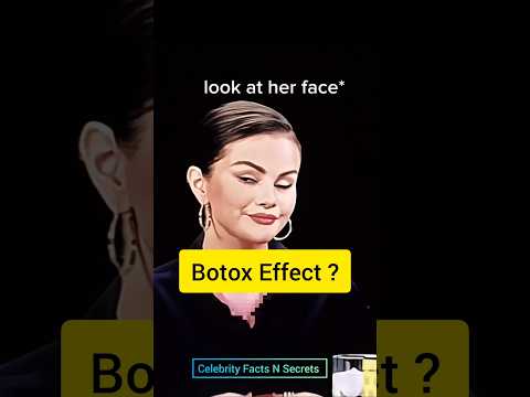 Selena Gomez’s Face Shocks Fans — Botox or Breakdown?