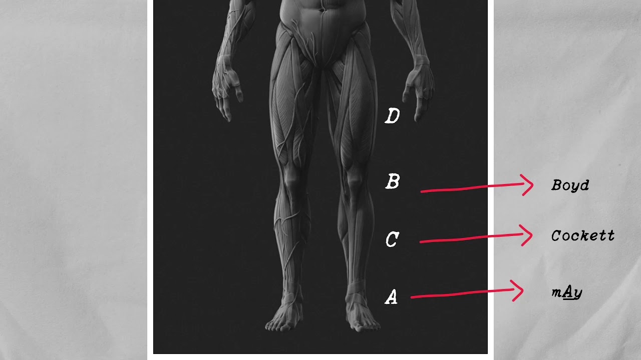 1. Venous system - Perforators - Sample video - YouTube