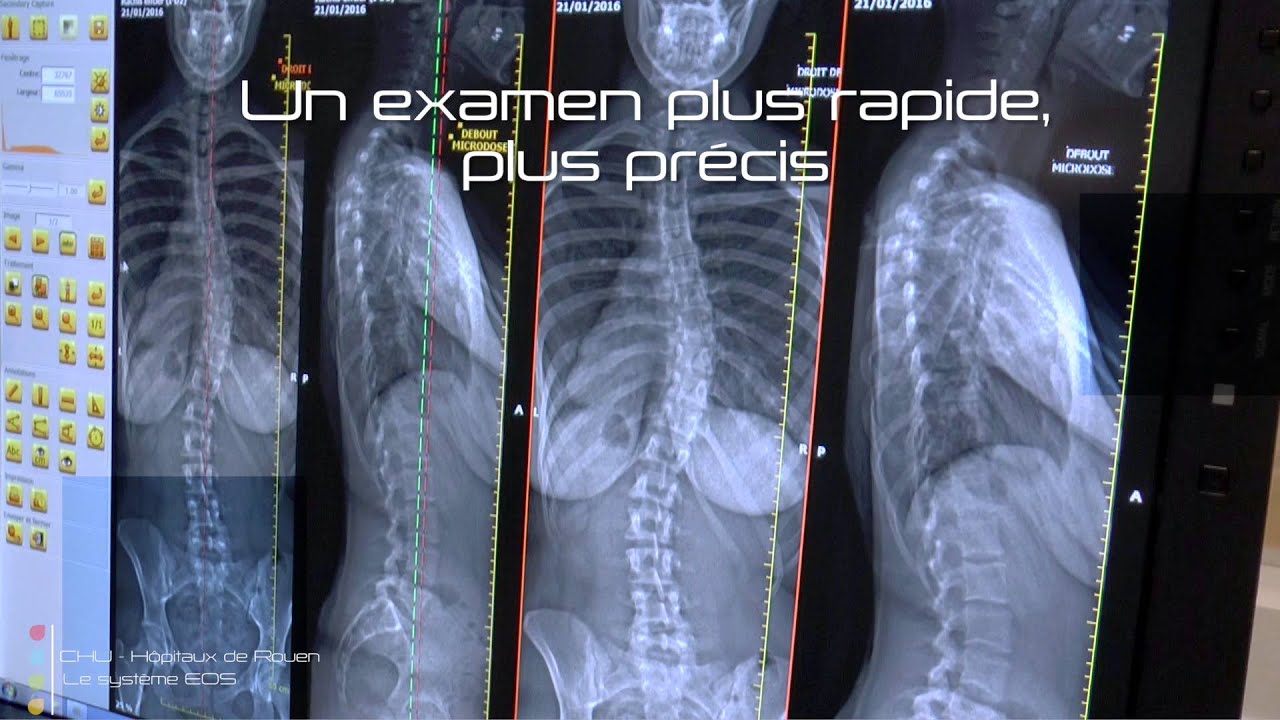 Le système EOS - YouTube