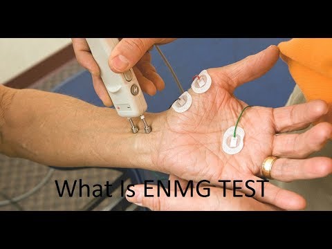 ENMG టెస్ట్ అంటే ఏమిటి | What is ENMG Test | Health Tips - YouTube