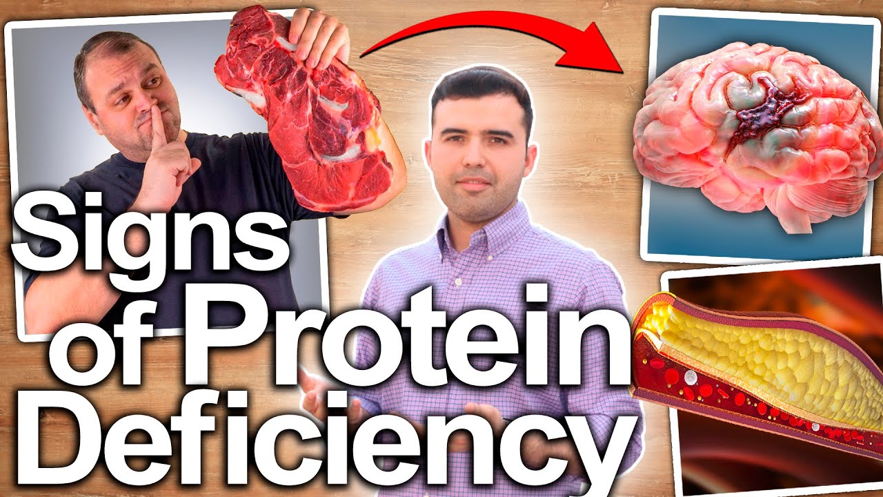 6 Clear Signs You Might Have a Protein Deficiency Symptoms of What You ...