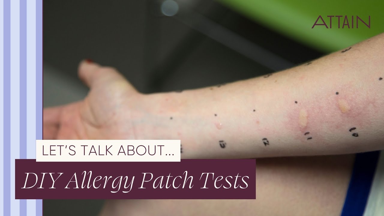 DIY Nail Allergy Patch Testing: What You Need to Know Before You Try It ...
