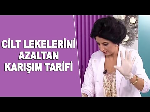 Şems Arslan'dan cilt lekelerini azaltan karışım