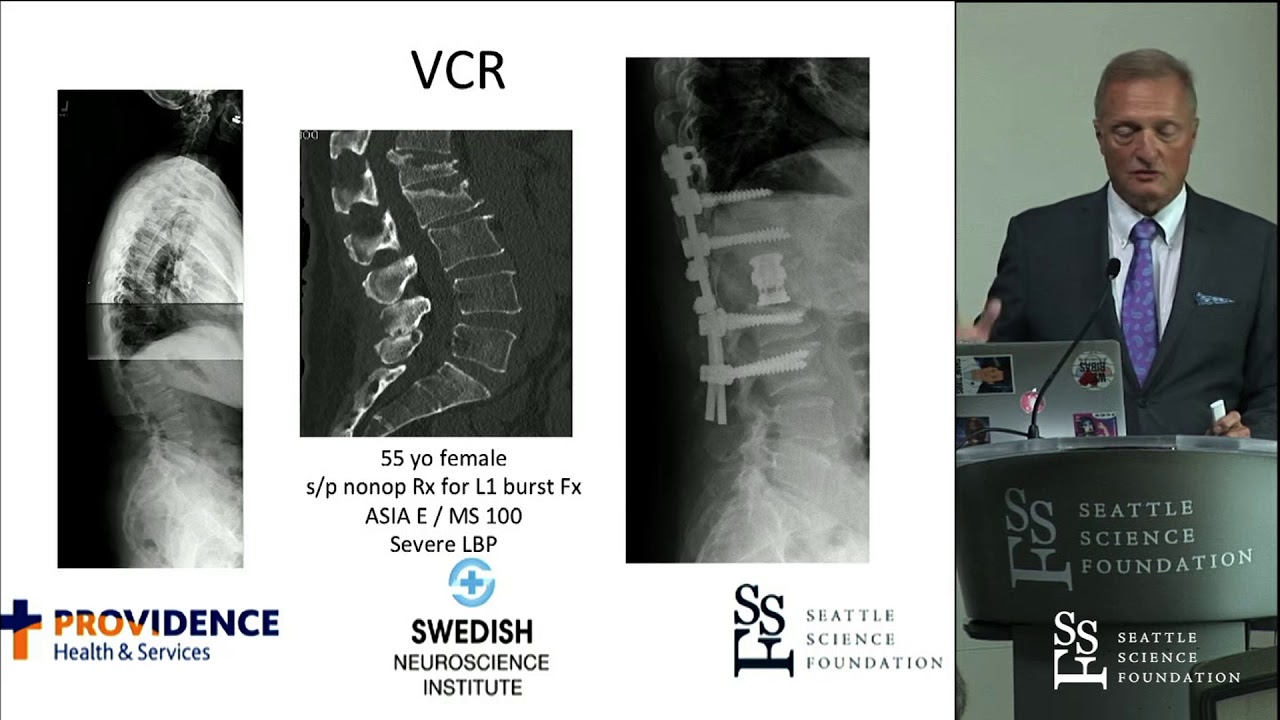 Three Column Osteotomy for Correction of Spinal Deformities - Jens R ...
