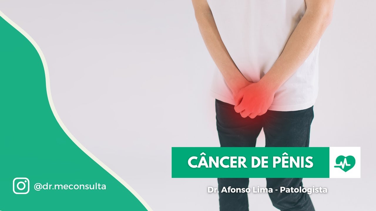 Câncer de Pênis: Quais são os sintomas? - YouTube