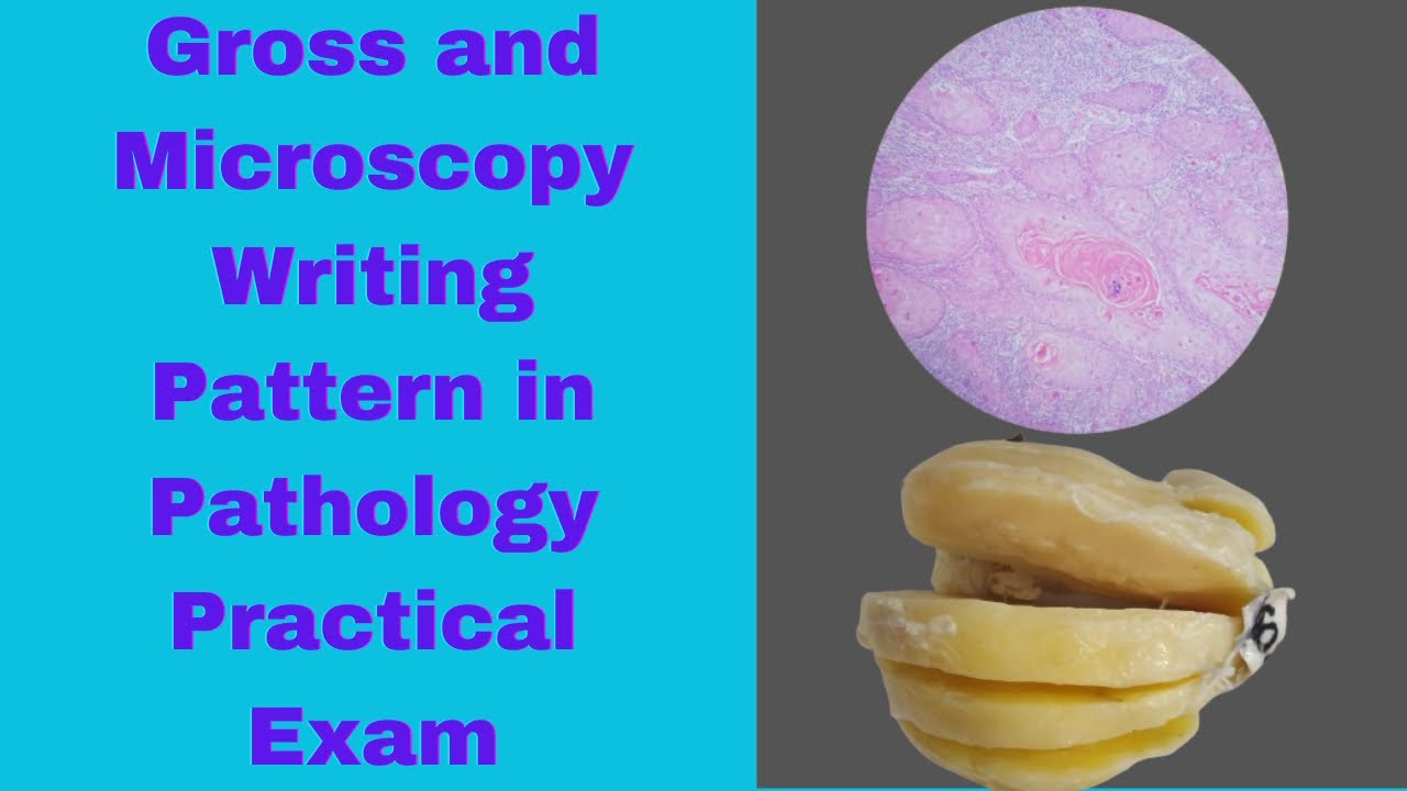 Writing pattern of Microscopy and Gross features in Pathology Practical ...