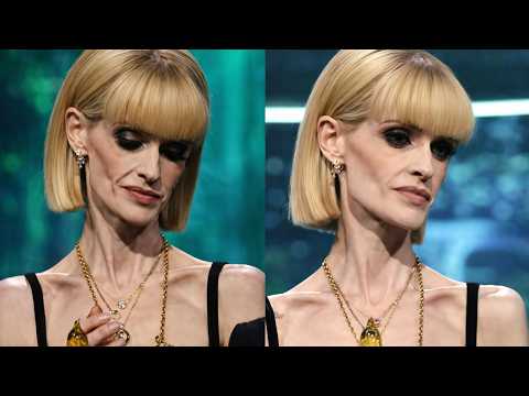 These Celebs Are ADDICTED TO OZEMPIC (Before & After Photos)