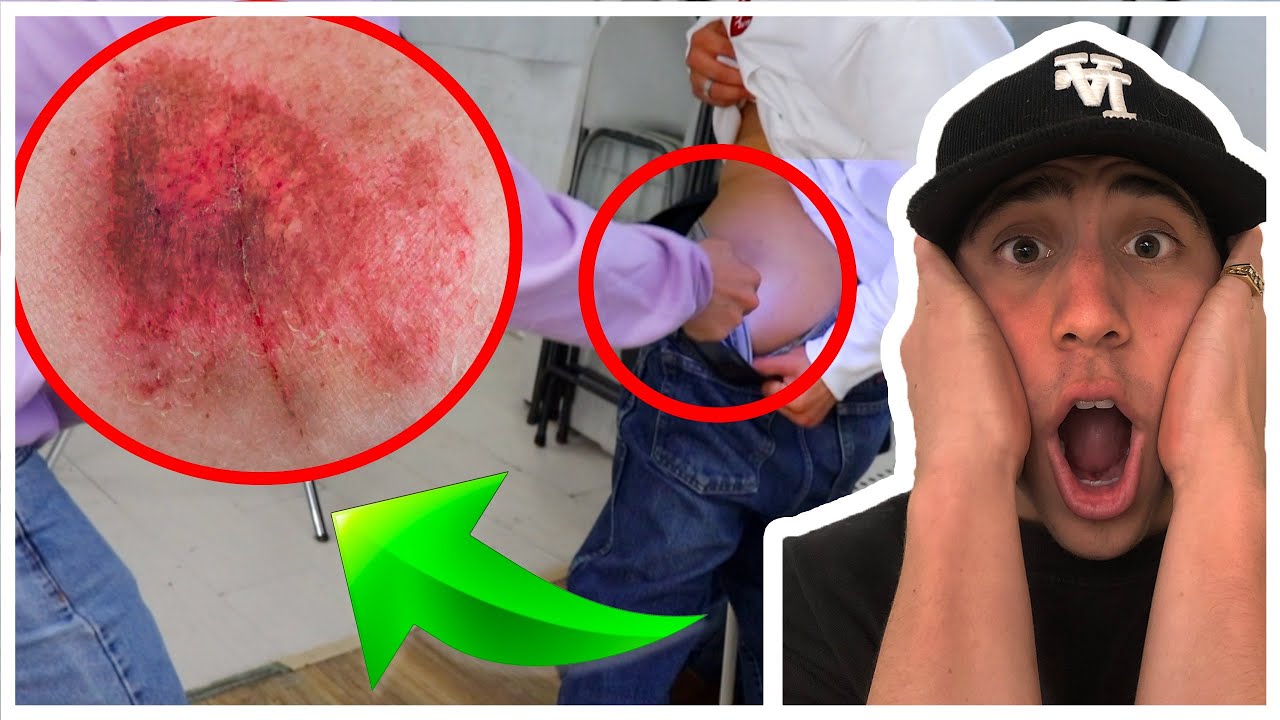 TAZING OUR FRIENDS IN THE A**!!! (HE SH*T HIMSELF) - YouTube