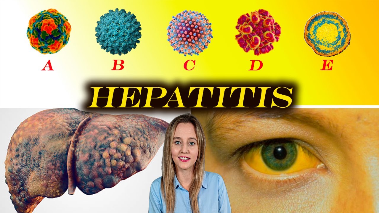 HEPATITIS | A, B, C, D, E | SÍNTOMAS, TRANSMISIÓN, DIAGNÓSTICO Y ...