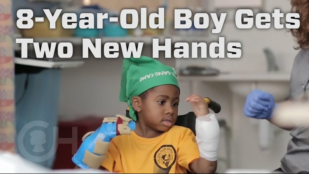 8-Year-Old Boy Gets Two New Arms After Amputation - YouTube