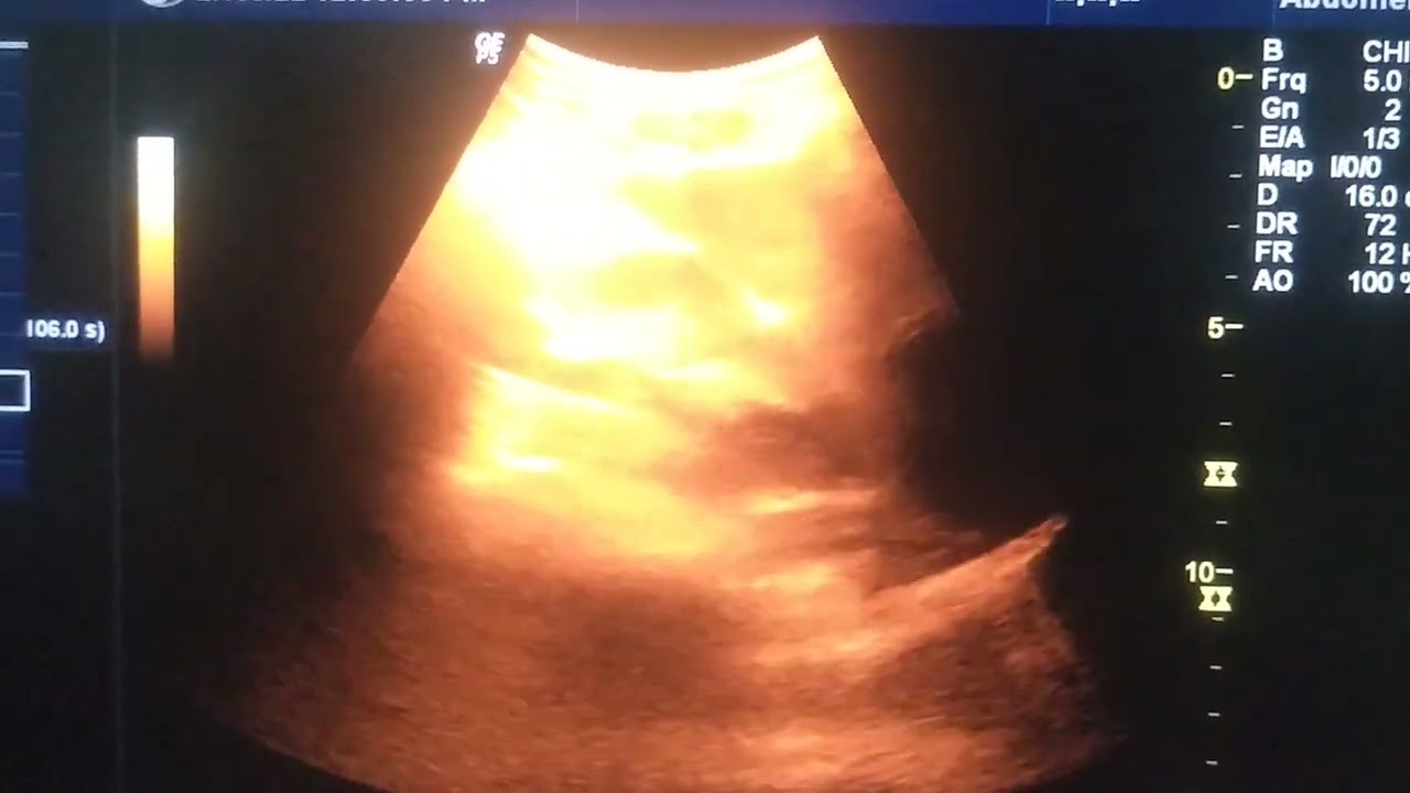 GE logiq P5 machine ON system - YouTube