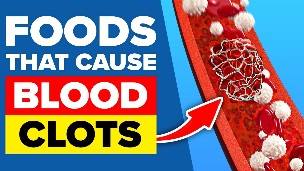 TOP 5 Worst Foods that Cause Blood Clots - YouTube