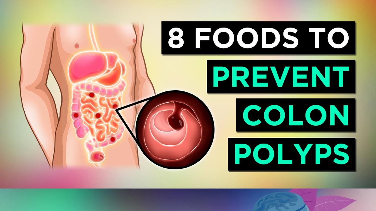 8 Foods To Prevent Colon Polyps And Bowel Cancer Youtube