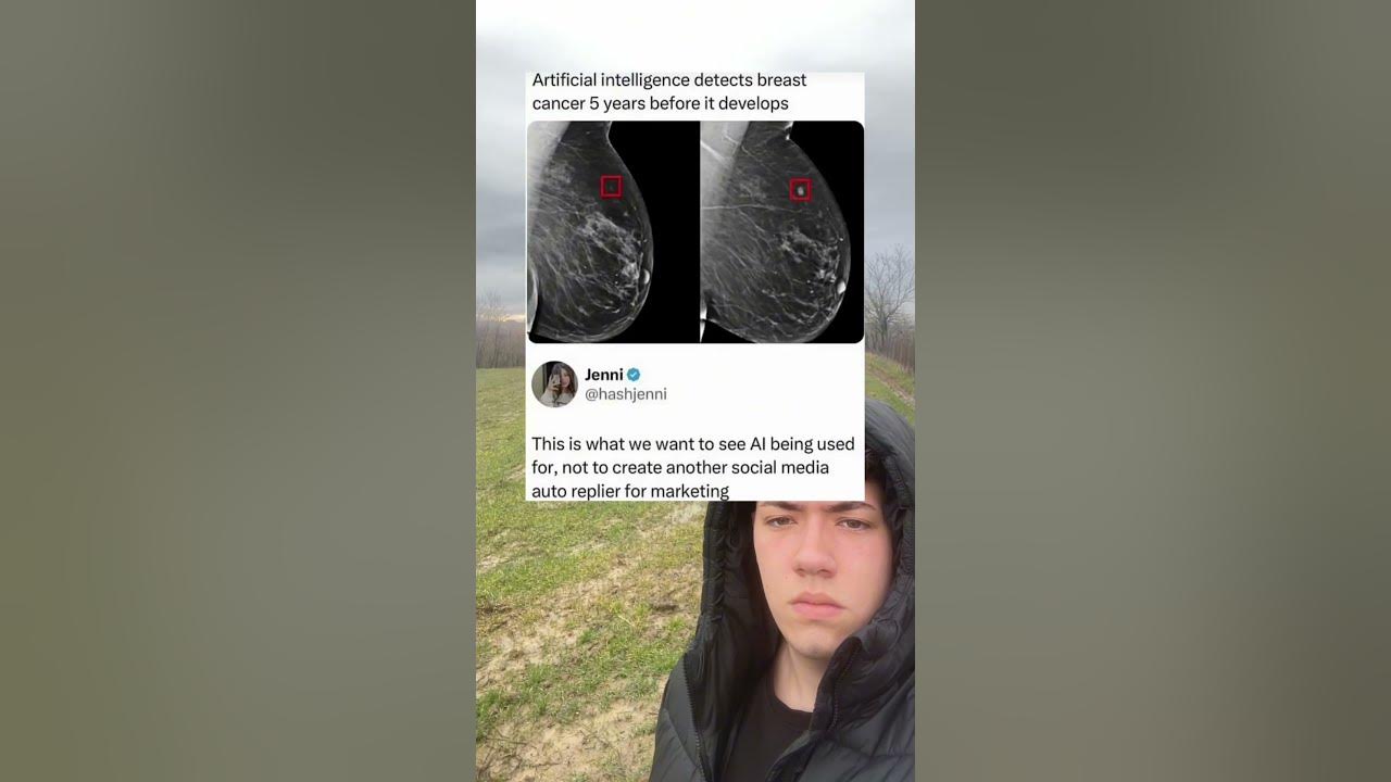 Artificial intelligence detects breast cancer 5 years before it ...