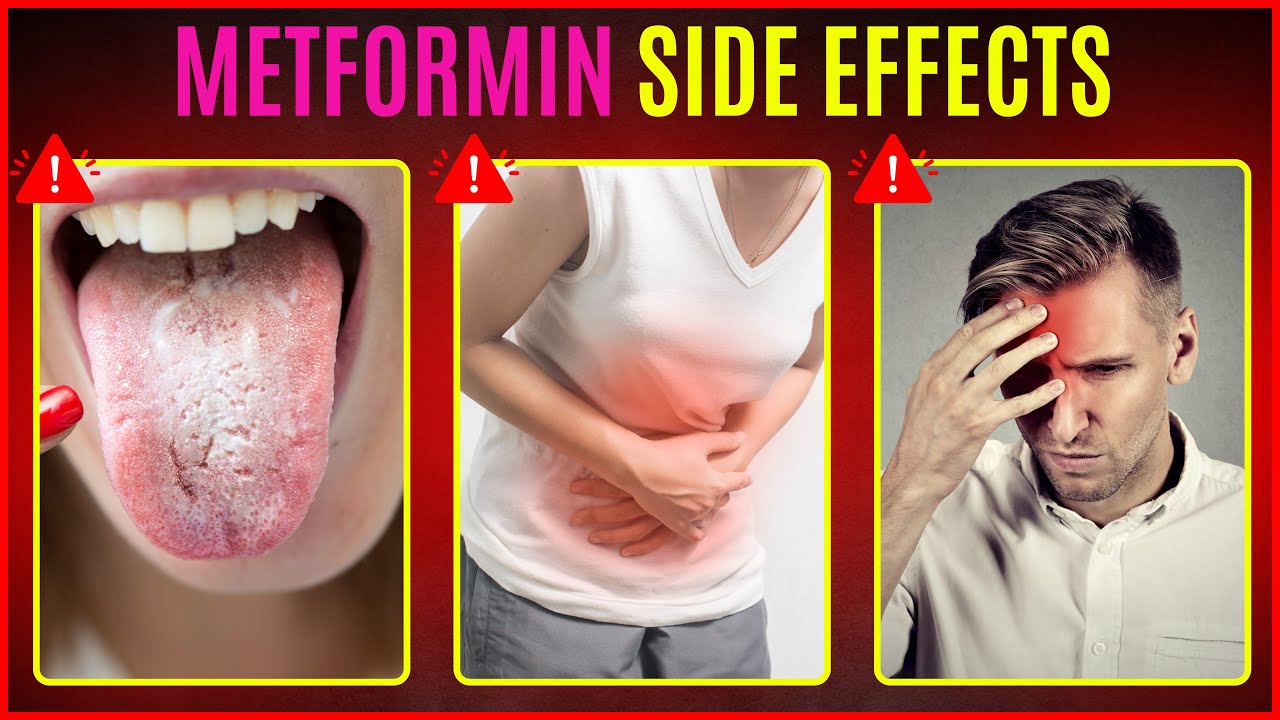 METFORMIN SIDE EFFECTS (Doctors Never Say These Side Effects Of ...