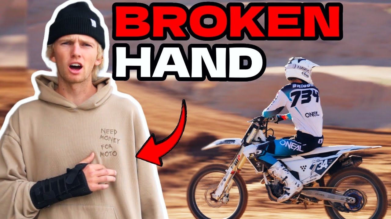 RACING WITH A BROKEN HAND - YouTube