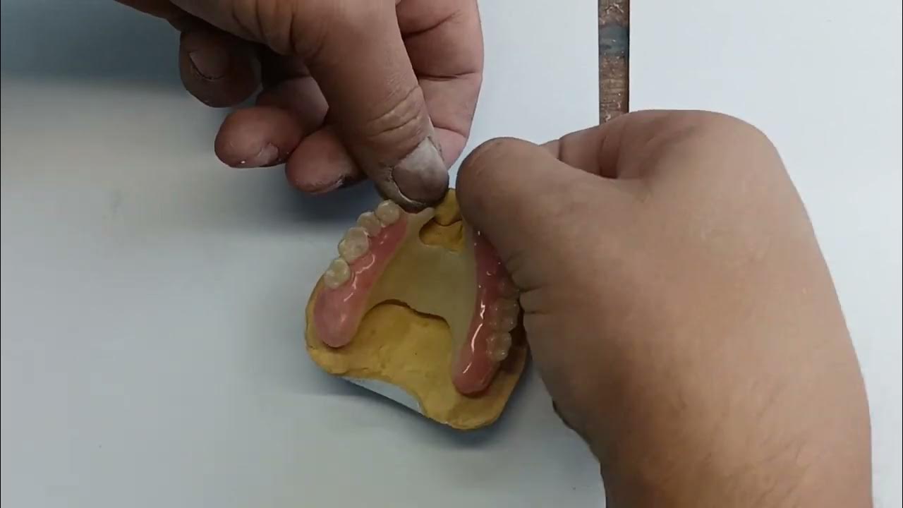 Ацеталовый протез. (освоил) - YouTube