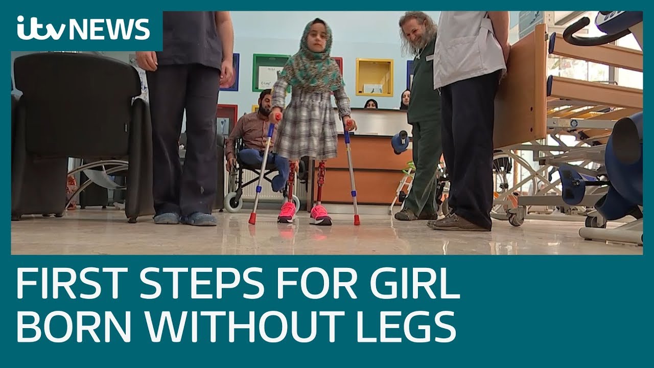 Doctor’s kindness sees girl born without legs takes her first steps on ...