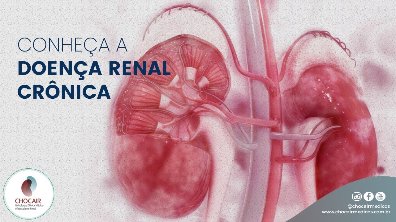 Conheça a Doença Renal Crônica | Chocair Médicos Associados - YouTube