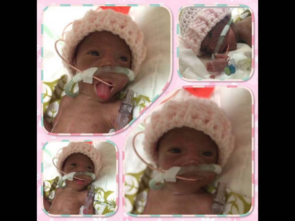 Maia's NICU Journey - 25 week micro preemie - YouTube