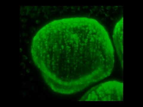 Inversion of a Volvox embryo - live imaging - YouTube