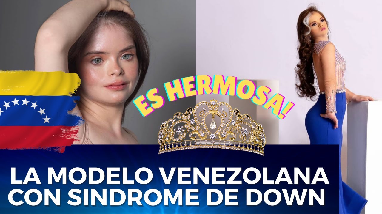 La Modelo Venezolana con Sindrome de D*wn / Jessica Jacinto - YouTube