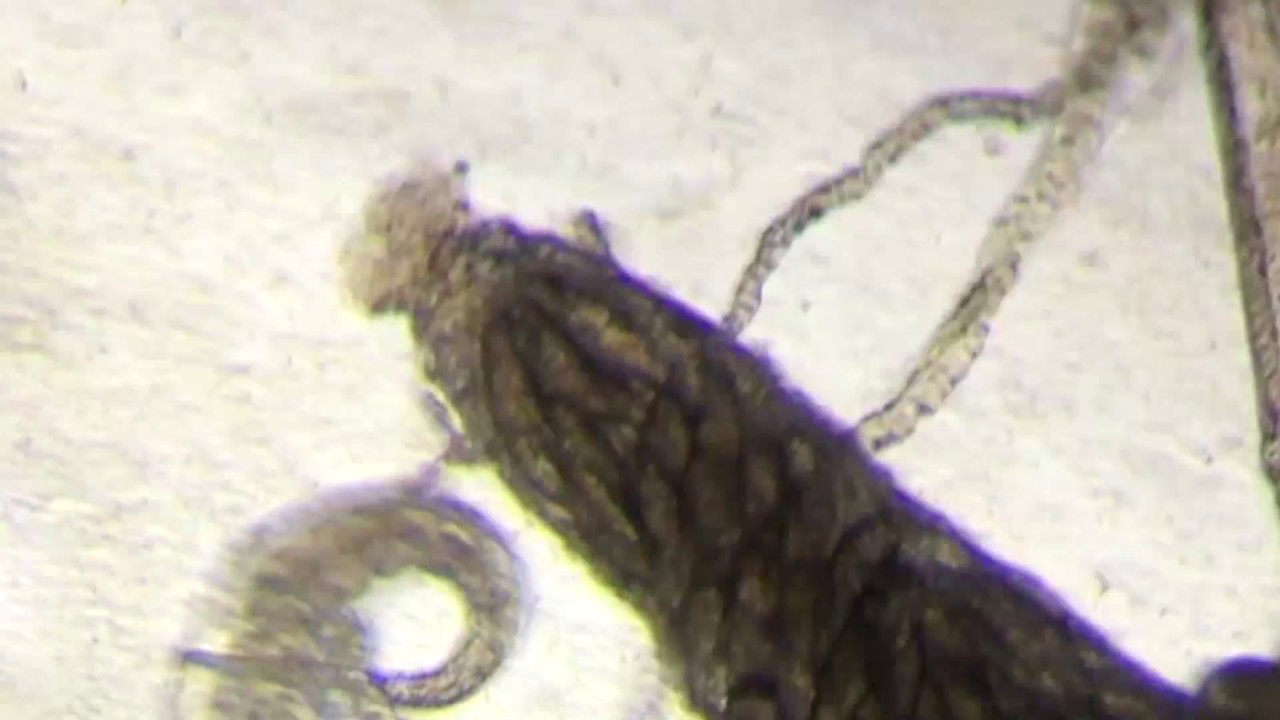 Syphacia Obvelata with moving eggs - YouTube