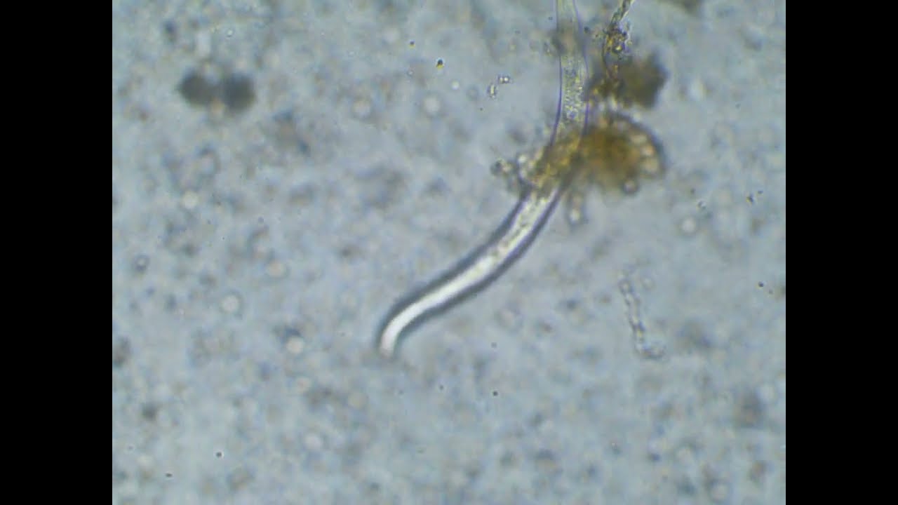 How To See Nematodes Under Microscope