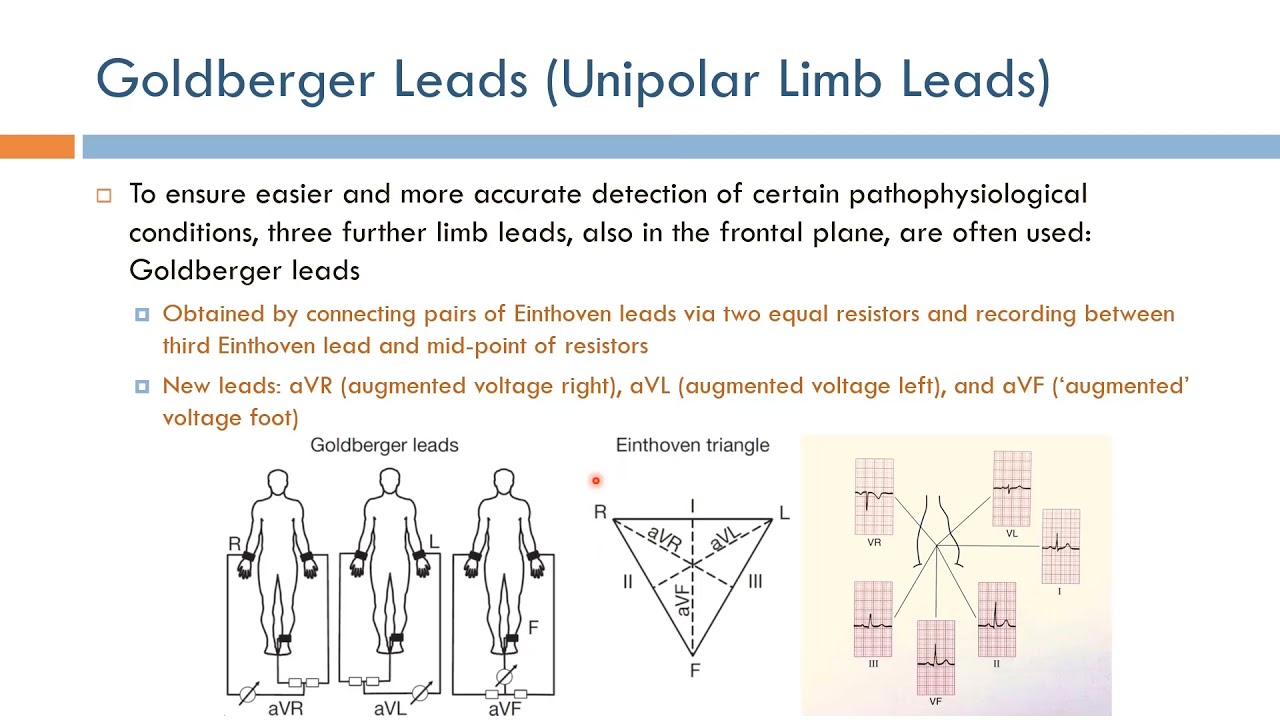 Short Topics in ECG: Goldberger (Unipolar Limb) Leads (Arabic Narration ...