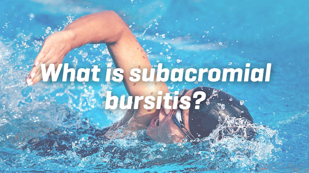 What is sub-acromial bursitis? - YouTube