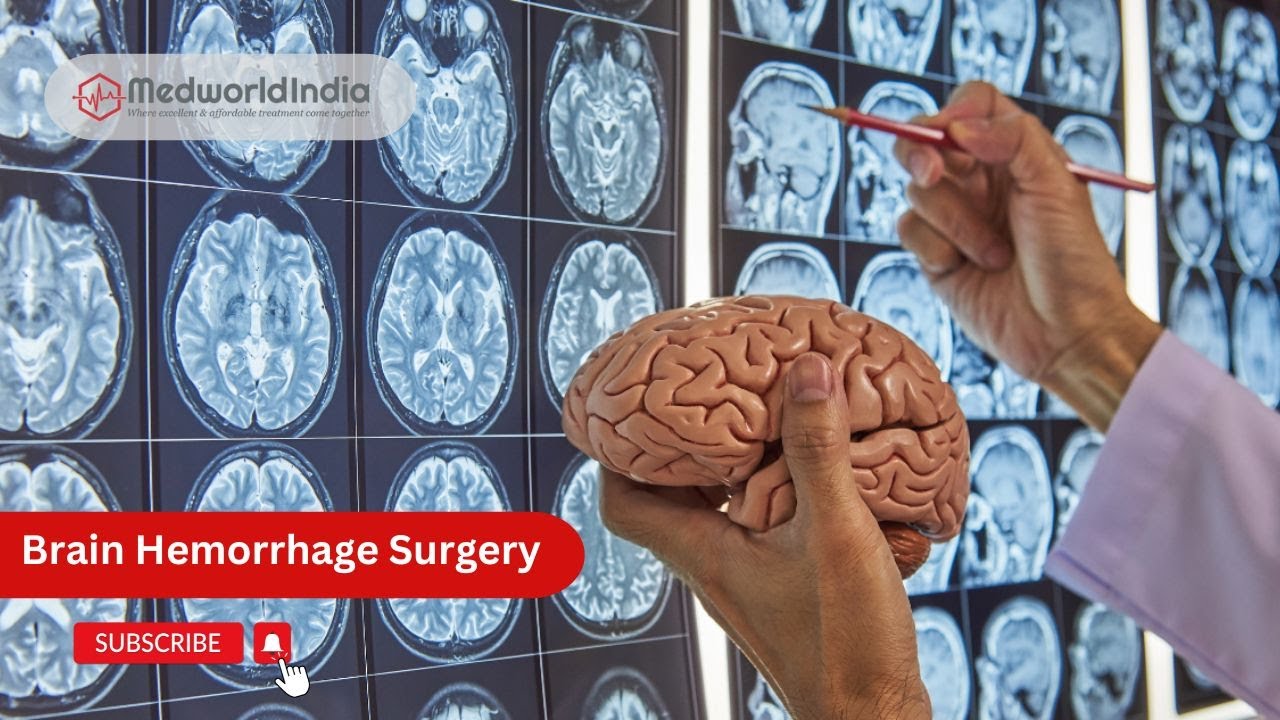 Life After Brain Hemorrhage Surgery Recovery & Tips | Medworldindia ...