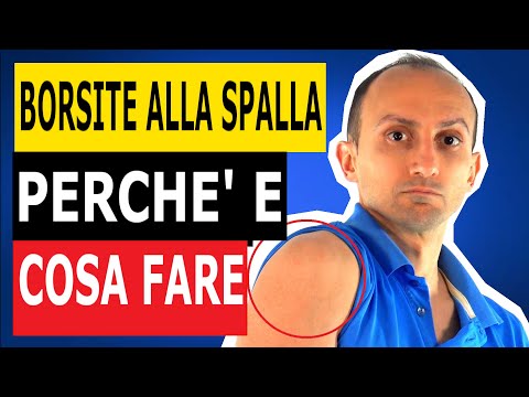 Borsite alla Spalla: Perché, i Sintomi e Cosa Fare Spiegato ...