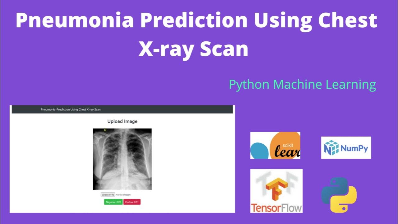 Pneumonia Prediction Using chest x-ray Image Machine Learning | CNN ...