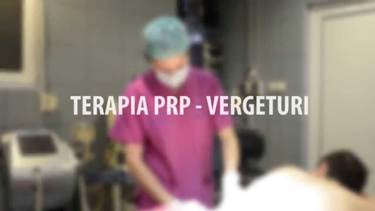 Tratament PRP- terapia Dracula - vergeturi - YouTube
