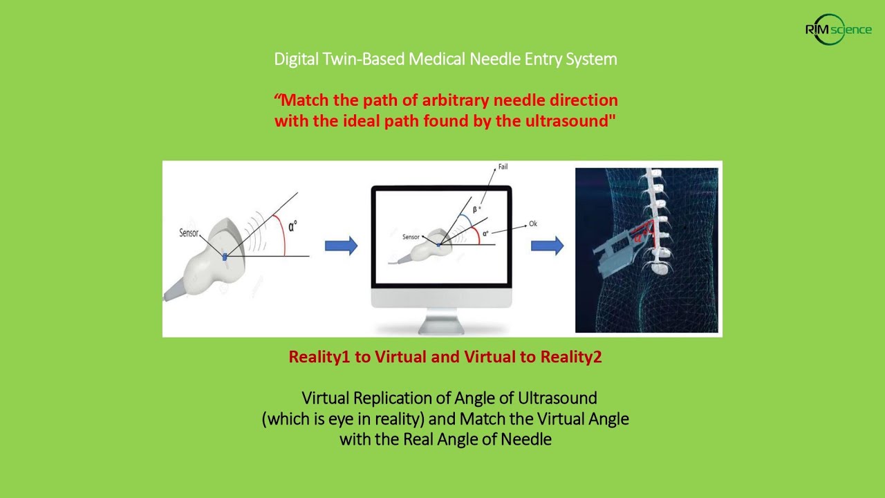 Digital Twin-Based smart needle navigation system for percutaneous ...