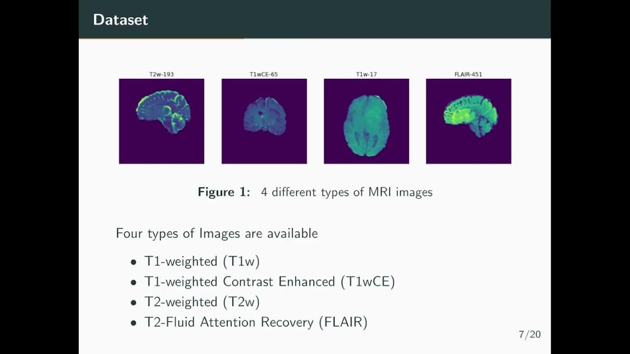 Brain Tumor Segmentation (BraTS) challenge 2020 - An Overview - YouTube
