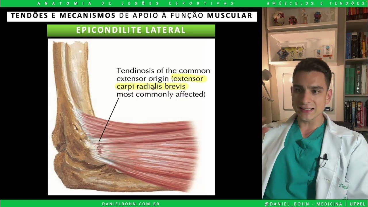 Epicondilite Lateral #ANATOMIA | Daniel Bohn - YouTube