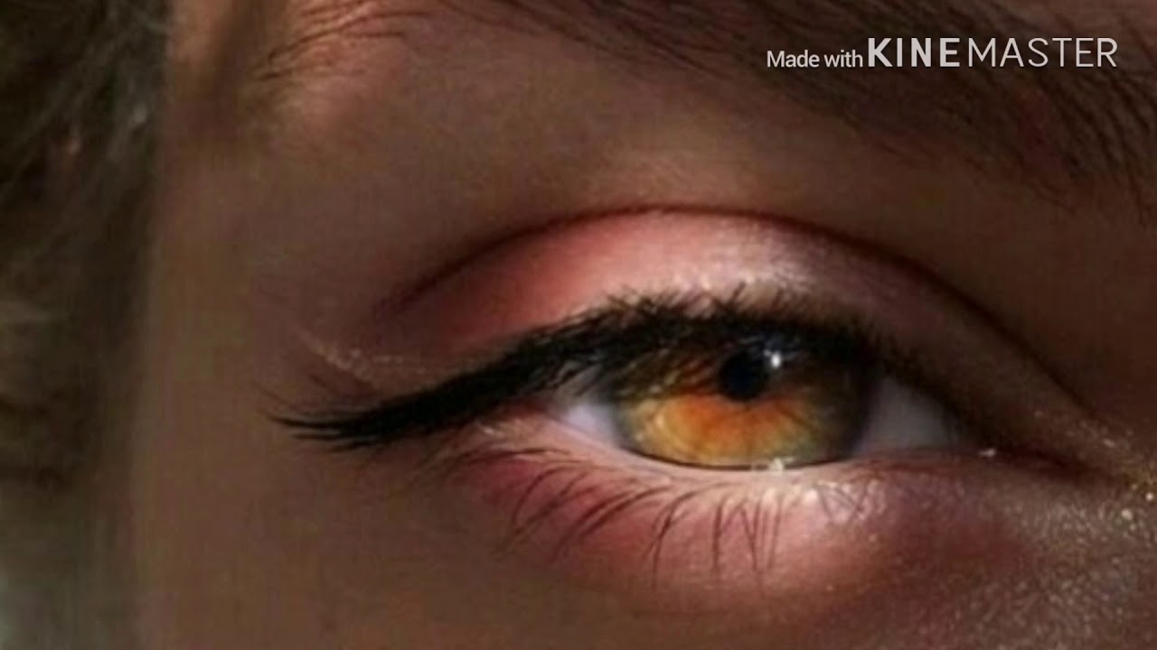 Bye bye eye melanin*CAUTION POWERFULLL* - YouTube