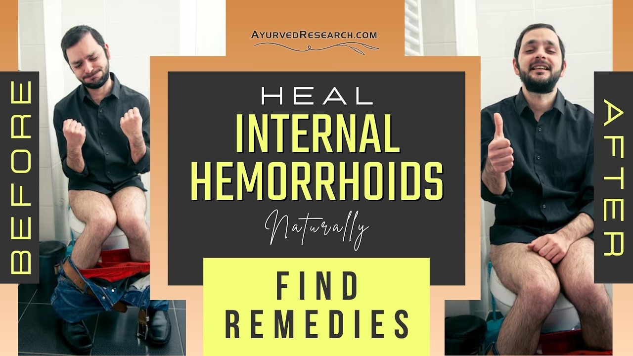 How to Heal Internal Hemorrhoids | Get Relief from Hemorrhoid Symptoms ...