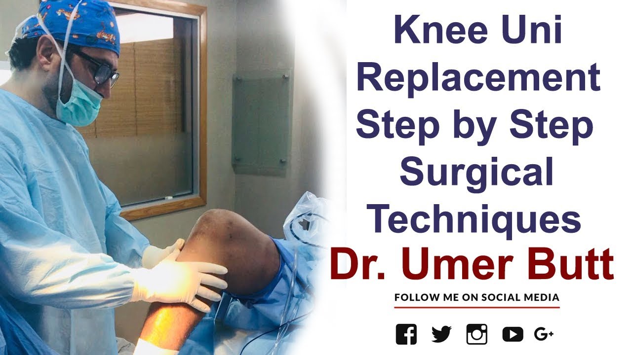 Knee Uni Replacement - Surgical Technique Steps - Best Orthopedic Surgeon In Pakistan Dr. Umer ...